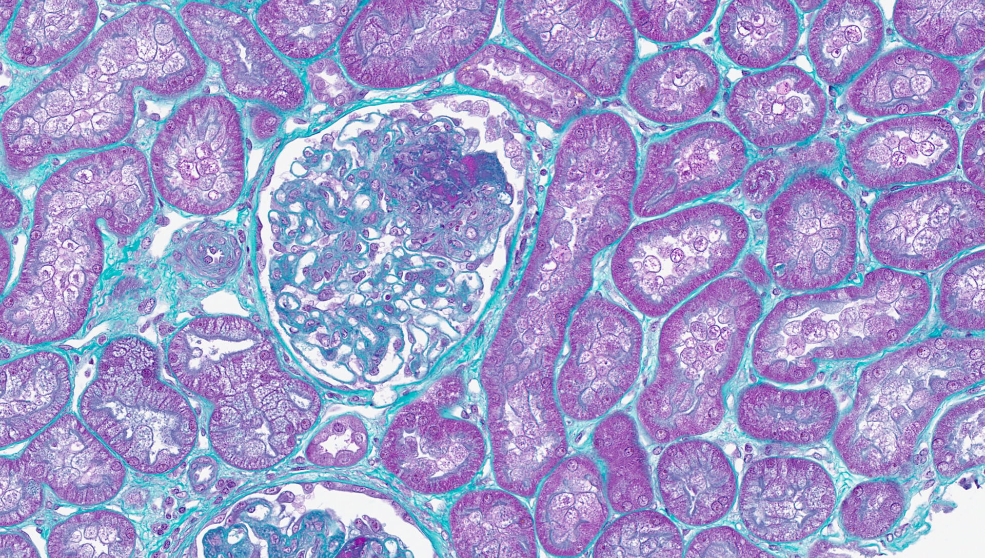 Rare systemic autoimmune and autoinflammatory diseases in adults in Île ...